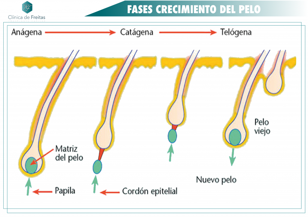 ¿Qué es la alopecia y qué significa? | Clínica de Freitas