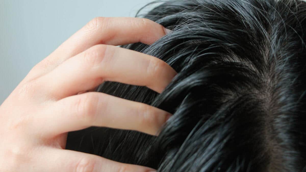 ¿Por qué tengo el pelo graso y fino? | Clínica de Freitas
